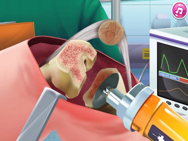 KNEE SURGERY SIMULATOR online game | POMU Games